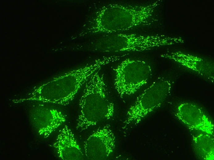 Rheumalabor Innsbruck • Ak gg. Mitochondrien (AMA)